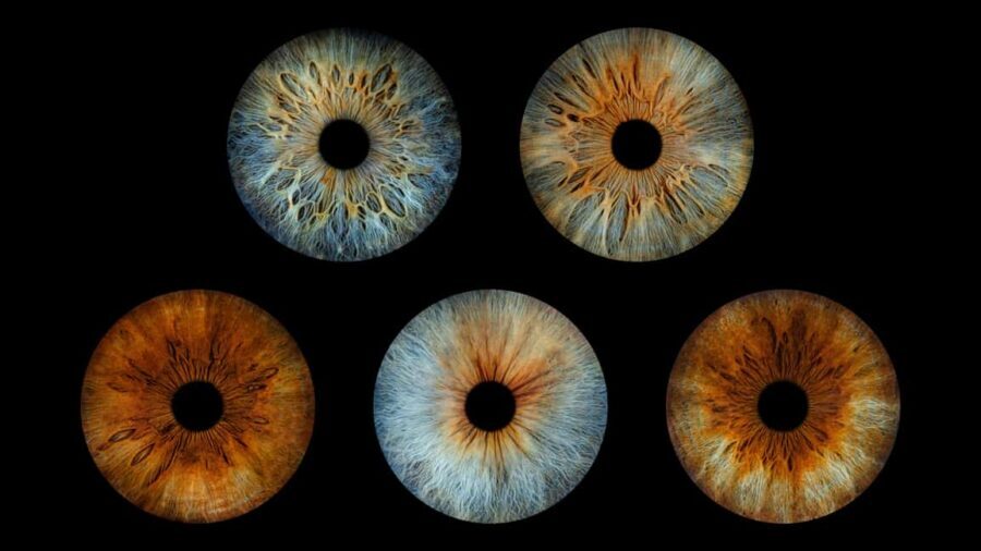 Deauville: Reveal the beauty of your iris with Iris Galerie - The Bottom Line: Is It Worth It?